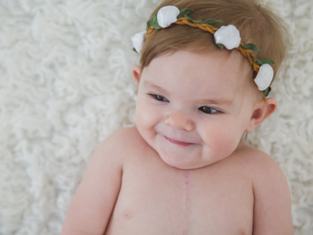 Children with scarring - Body in Harmony Training